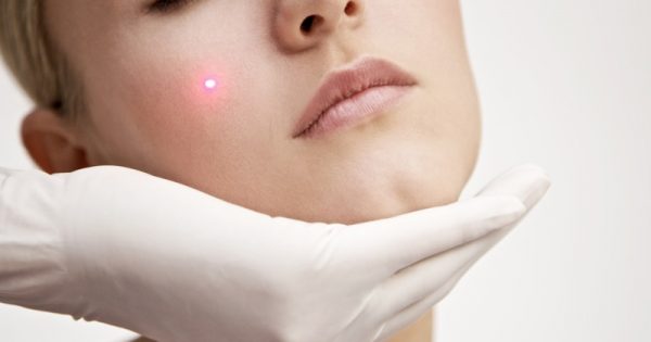 I Laser Che Rassodano Il Viso Donna Moderna