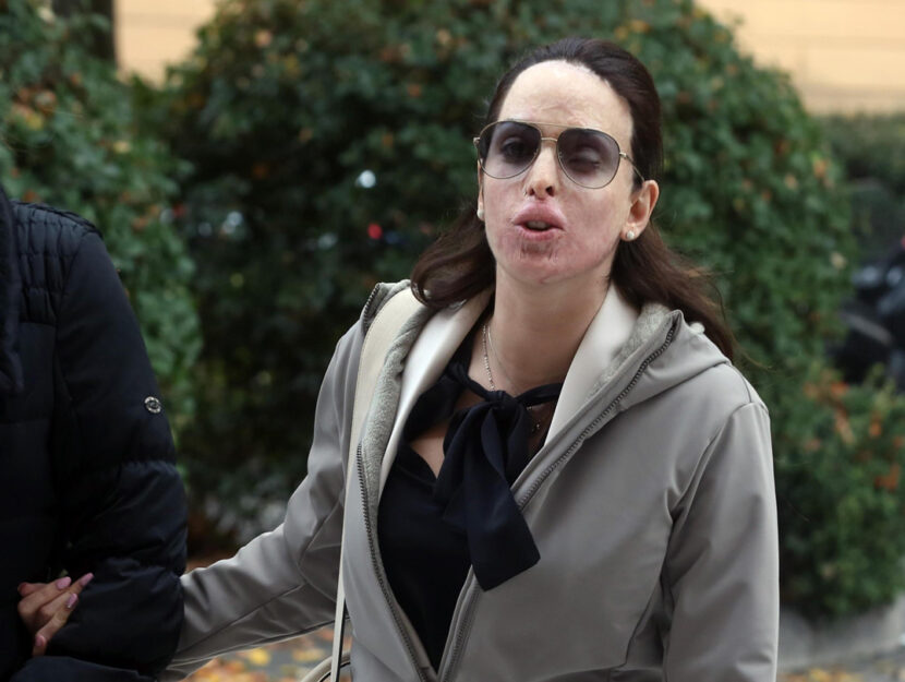 Non dimentichiamo le donne vittime di violenza - Donna Moderna