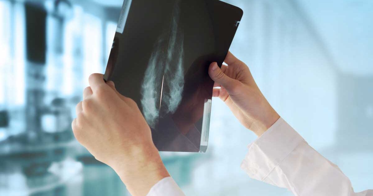 Protesi al seno e rischio tumore: le novità - Donna Moderna