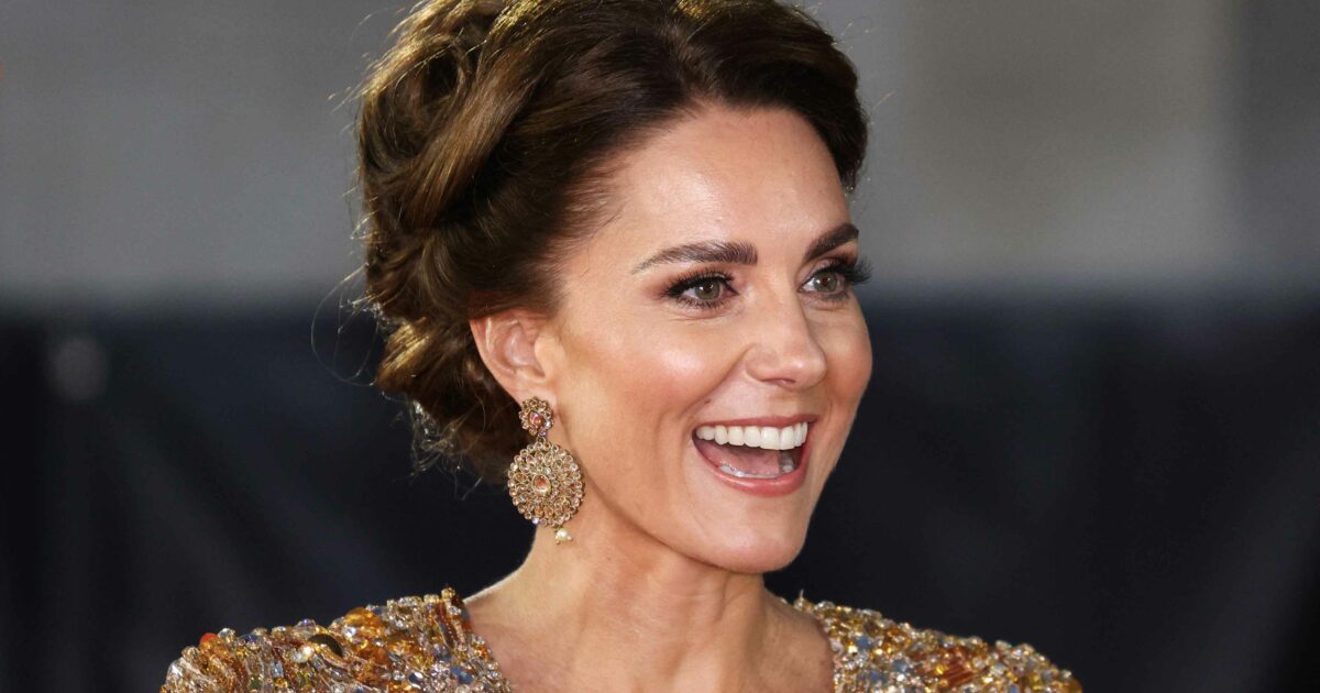 Il botox biologico per le rughe (che usa anche Kate) - Donna Moderna