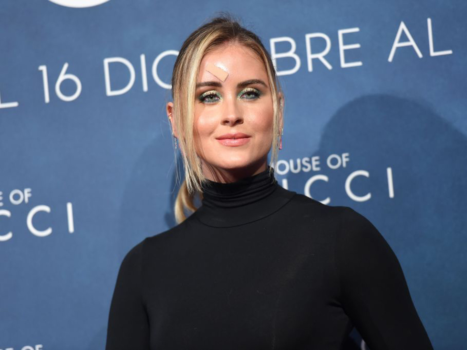 Cos’è il basalioma, il "brufolo" di Valentina Ferragni - Donna Moderna