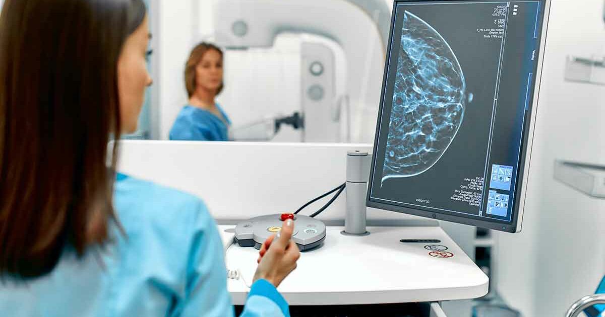 BRA Day: le ultime novità sulle protesi al seno - Donna Moderna