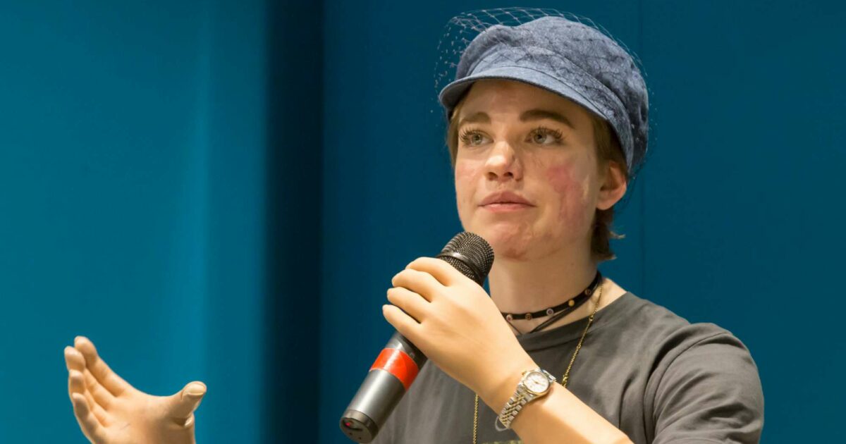 Il ritorno di Bebe Vio: "Ho fatto tre operazioni" - Donna Moderna