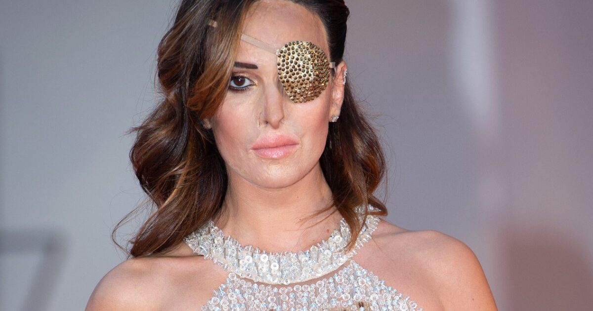 Gessica Notaro contro gli hater: "La chirurgia estetica mi ha salvato ...